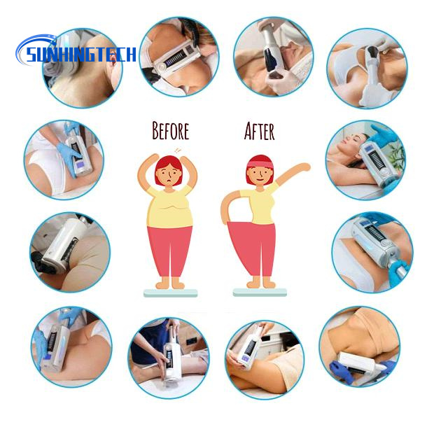 Portable Endosphere Roller Machine Smooth Cellulite Infrared Roller ...