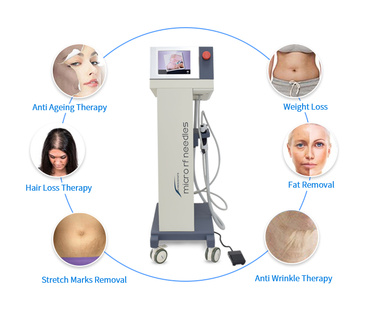 Fractional microneedle RF wrinkle removal skin tightening acne scar ...