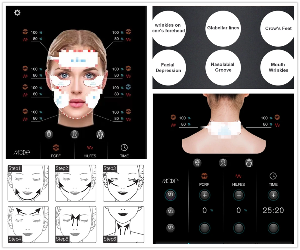 Portable Body & Face EMRF Face wrinkle removal EMS9 – Hebei Sunhingtech ...