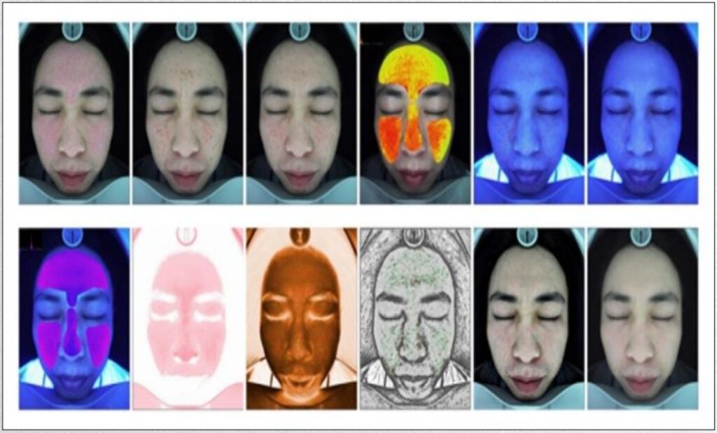 Smart Beauty Skin Analyzer Face Dermatology Device – Hebei Sunhingtech ...